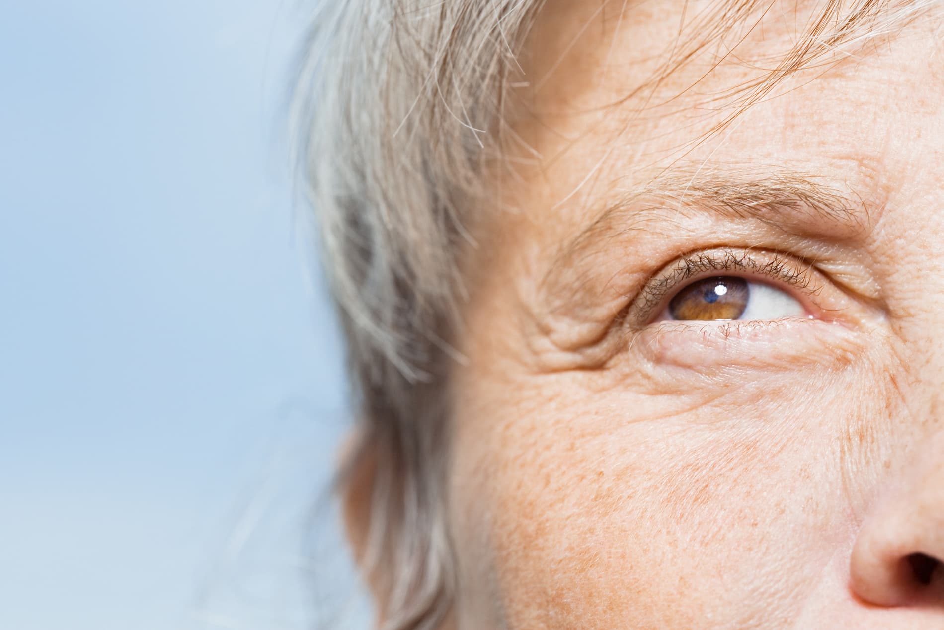 FOTODERMATOSIS EN EL PACIENTE MAYOR - Atención Primaria